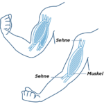 Spastik: Ursachen & Symptome | spastikinfo.de