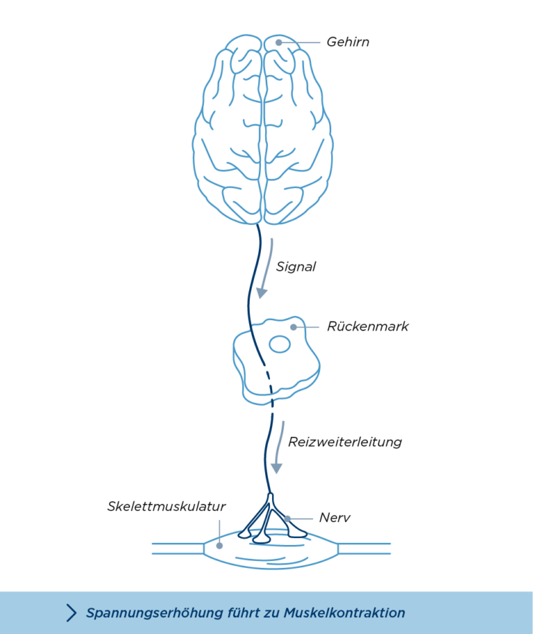Spastik: Ursachen & Symptome | spastikinfo.de