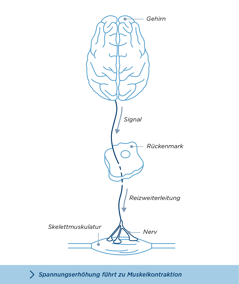 Spastik: Ursachen & Symptome | spastikinfo.de